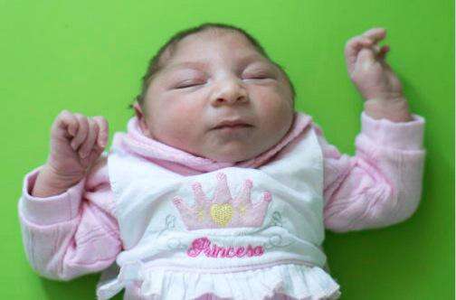 The impact of microcephaly - Jamaica Observer