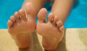 Having issues with your big toe? - Jamaica Observer