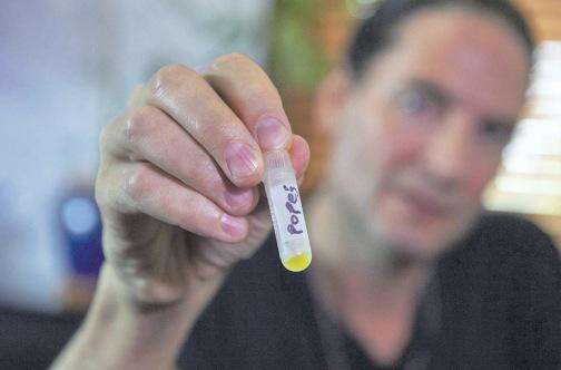 Snake man's venom habit holds hope for new antidote - Jamaica Observer