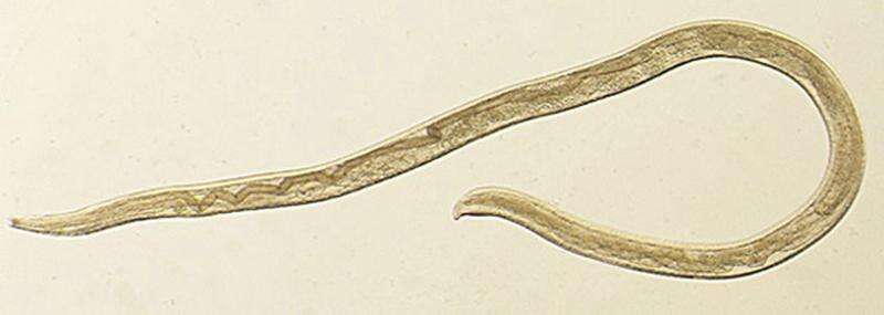 US woman had 14 worms pulled from her eye after rare infection ...