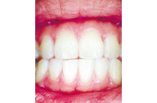 Ever heard of the gingival sulcus? - Jamaica Observer