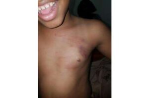 Who abused autistic child? - Jamaica Observer