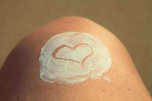 Lupus, photosensitivity and sunscreen use - Jamaica Observer