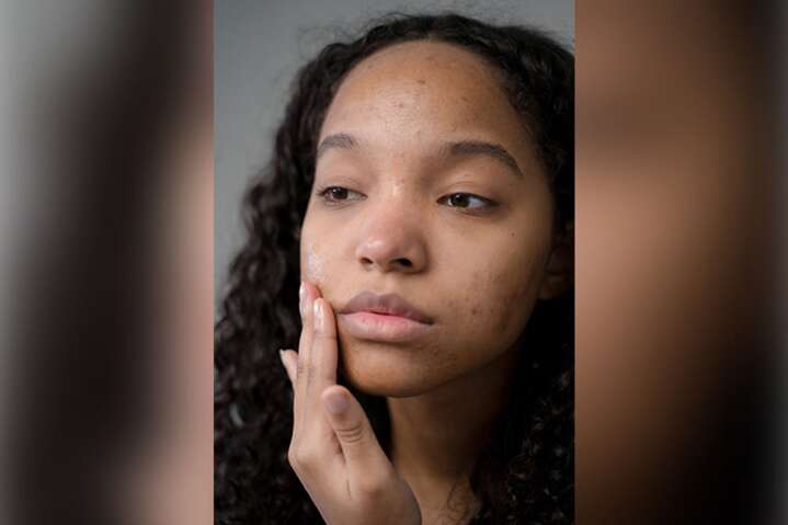 Teledermatology as a useful resource for healthy skin - Jamaica Observer