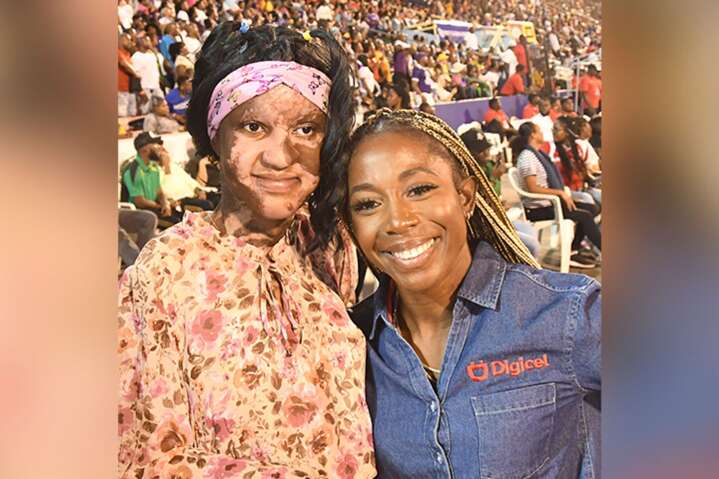 BURN VICTIM GETS WISH - Jamaica Observer