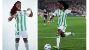 ‘It means a lot to me’: Reggae Girl Cameron proud to represent vitiligo ...