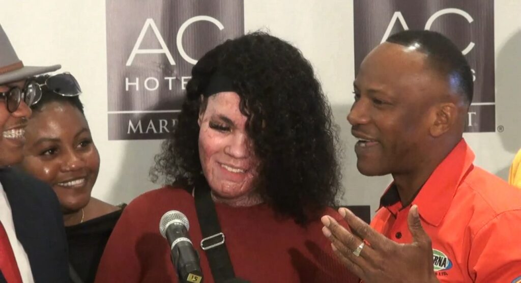 WATCH: Burn victim Alecia King grateful to be home - Jamaica Observer