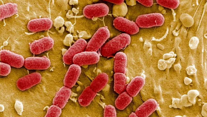 Drug-resistant superbugs projected to kill 39 million by 2050 - Jamaica ...