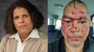 Guyana politician and social media blogger to face court after physical ...