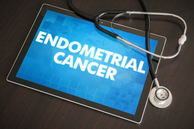 The rising burden of endometrial cancer in Jamaica - Jamaica Observer