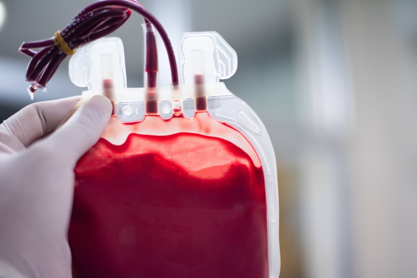 Give blood over money - Jamaica Observer